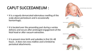 ABNORMALITIES OF HEAD SIZE AND SHAPE.pptx