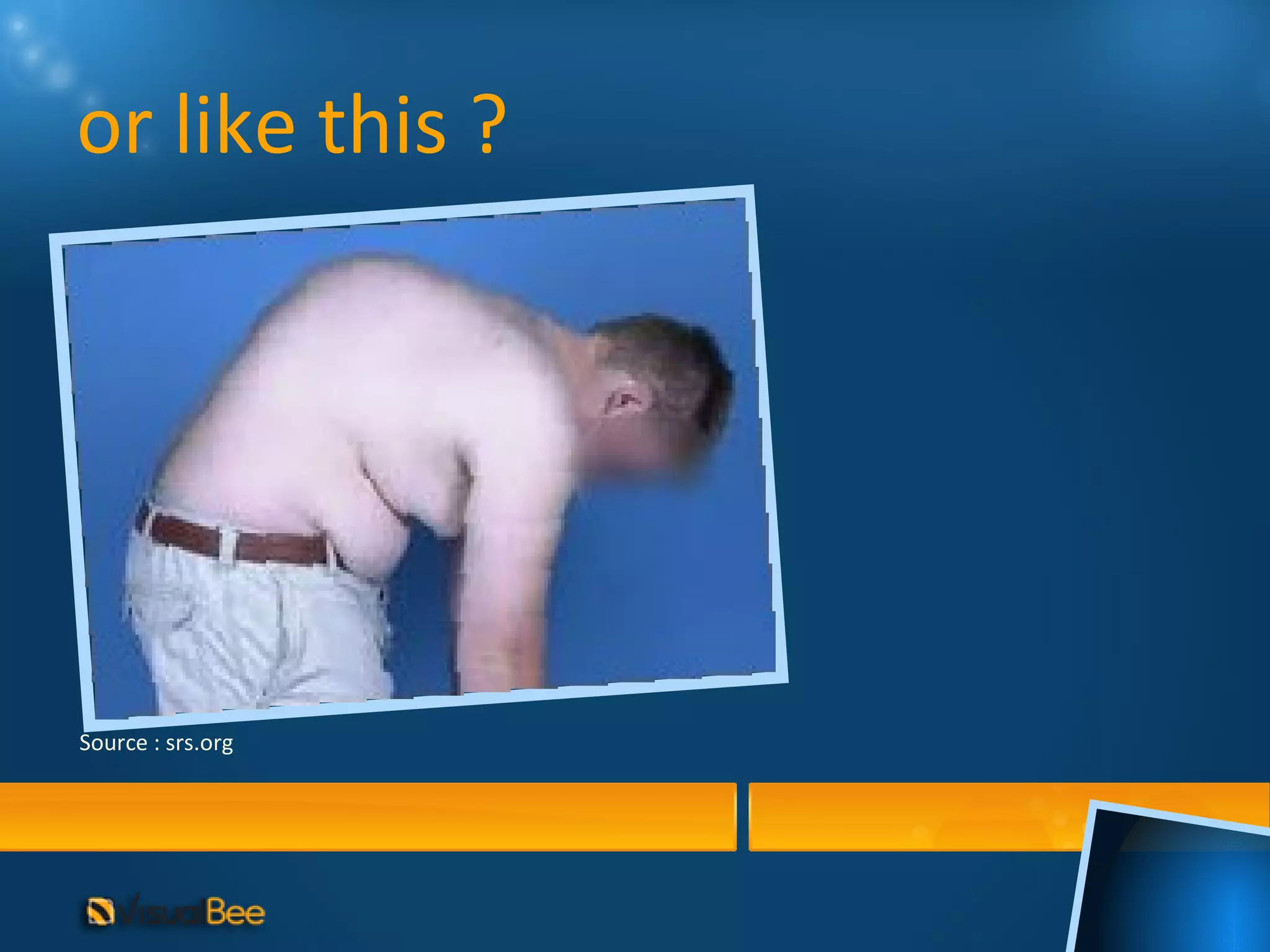 Abnormalities of movement system | PPT