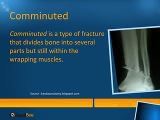 Abnormalities of movement system | PPT