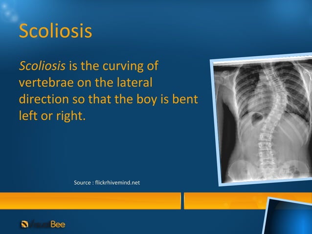 Abnormalities of movement system | PPT