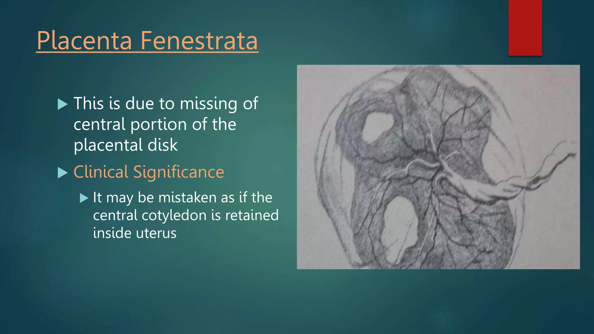 abnormalities of placenta.pptx