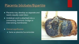 abnormalities of placenta.pptx