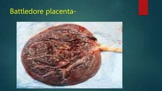 abnormalities of placenta.pptx
