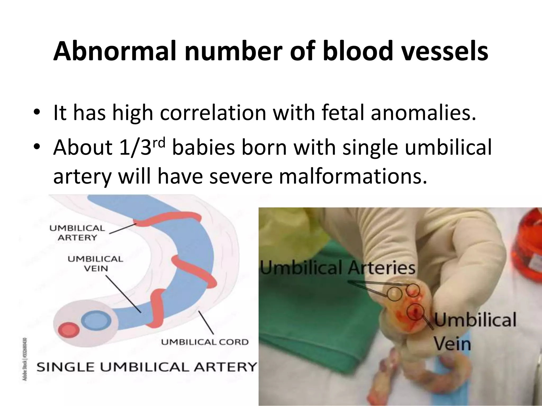 abnormalities of Placenta.pptx