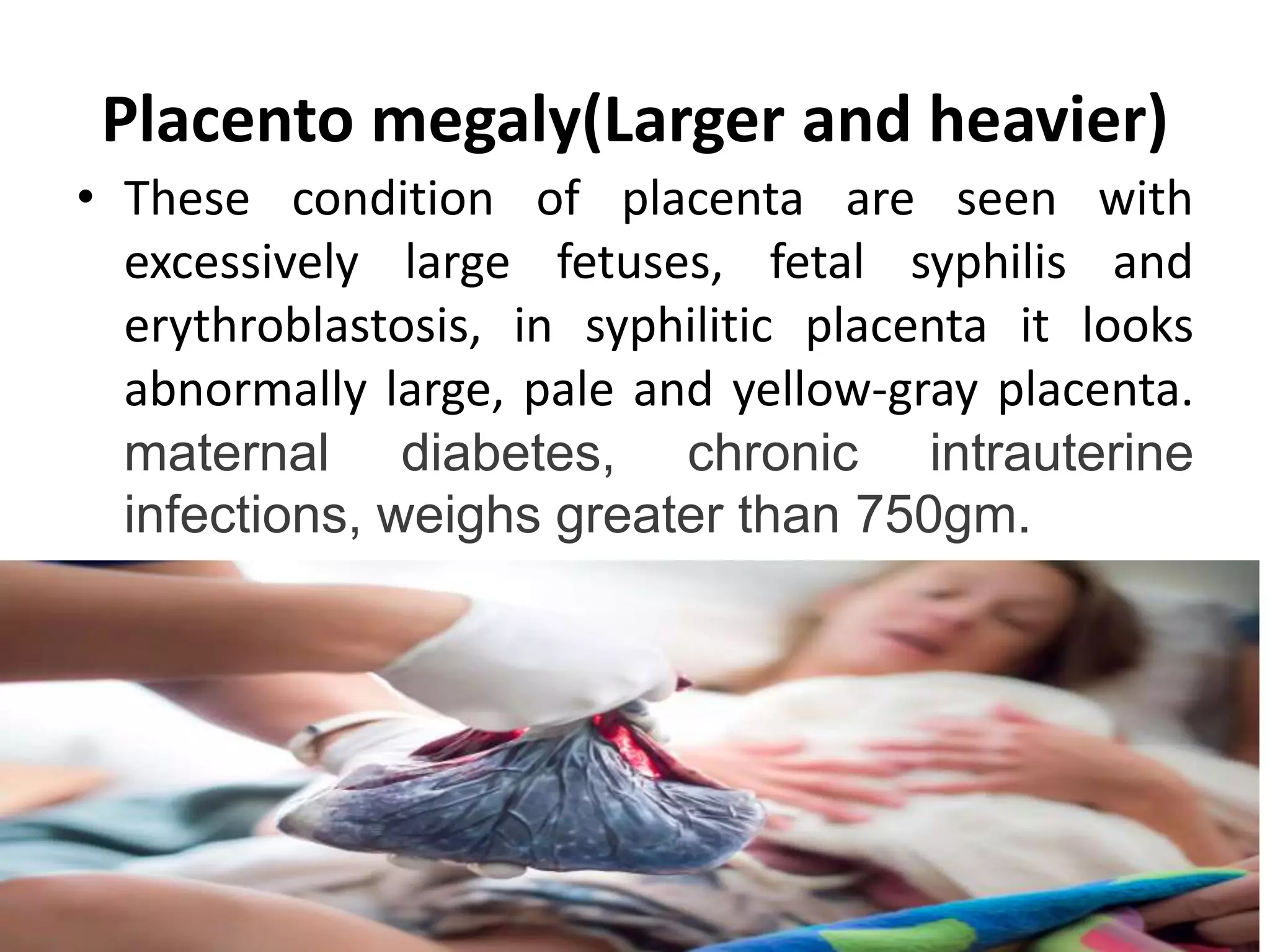 abnormalities of Placenta.pptx