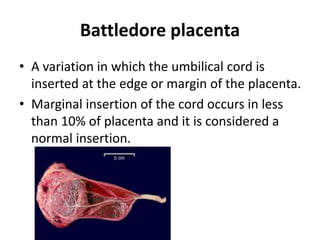 abnormalities of Placenta.pptx