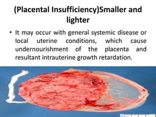 abnormalities of Placenta.pptx