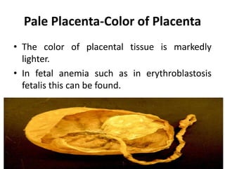 abnormalities of Placenta.pptx