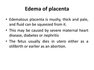 abnormalities of Placenta.pptx