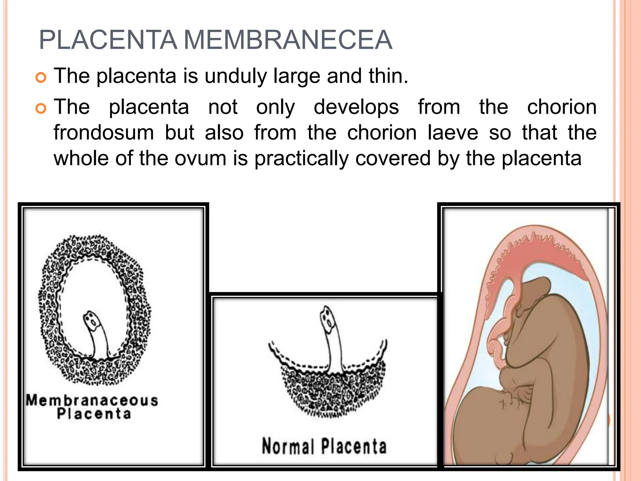 ABNORMALITIES OF PLACENTA AND CORD.pptx