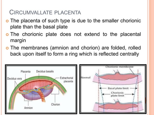 ABNORMALITIES OF PLACENTA AND CORD.pptx | Pregnancy | Reproductive Health