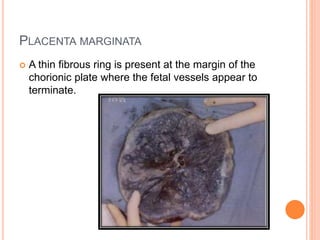 ABNORMALITIES OF PLACENTA AND CORD.pptx