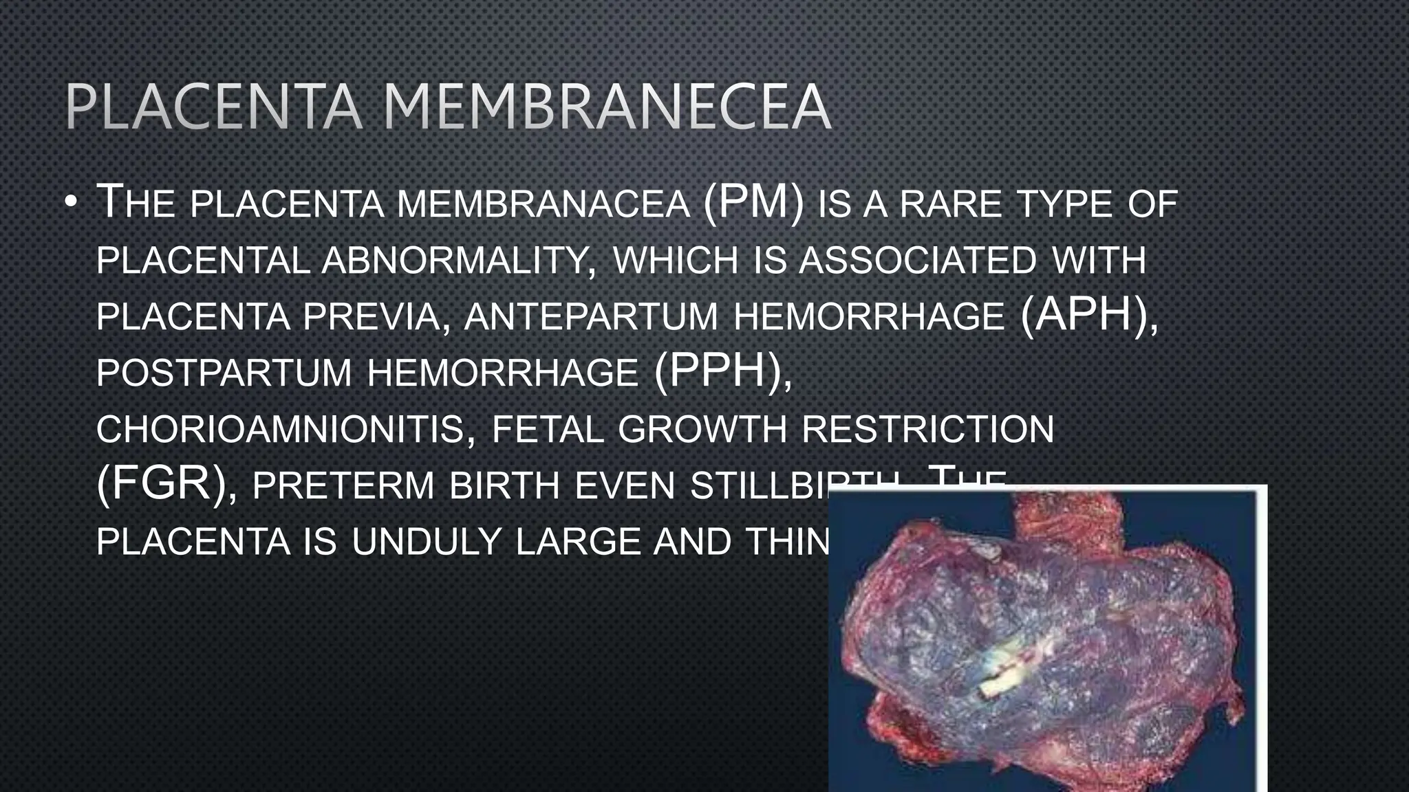 Abnormalities of placenta and cord (1).pptx