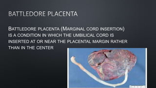 Abnormalities of placenta and cord (1).pptx | Pregnancy | Reproductive ...