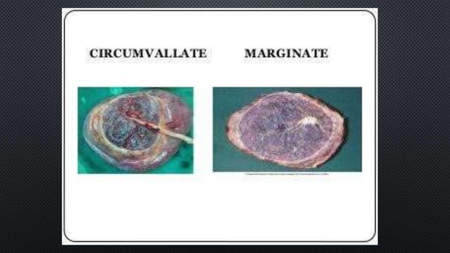 Abnormalities of placenta and cord (1).pptx