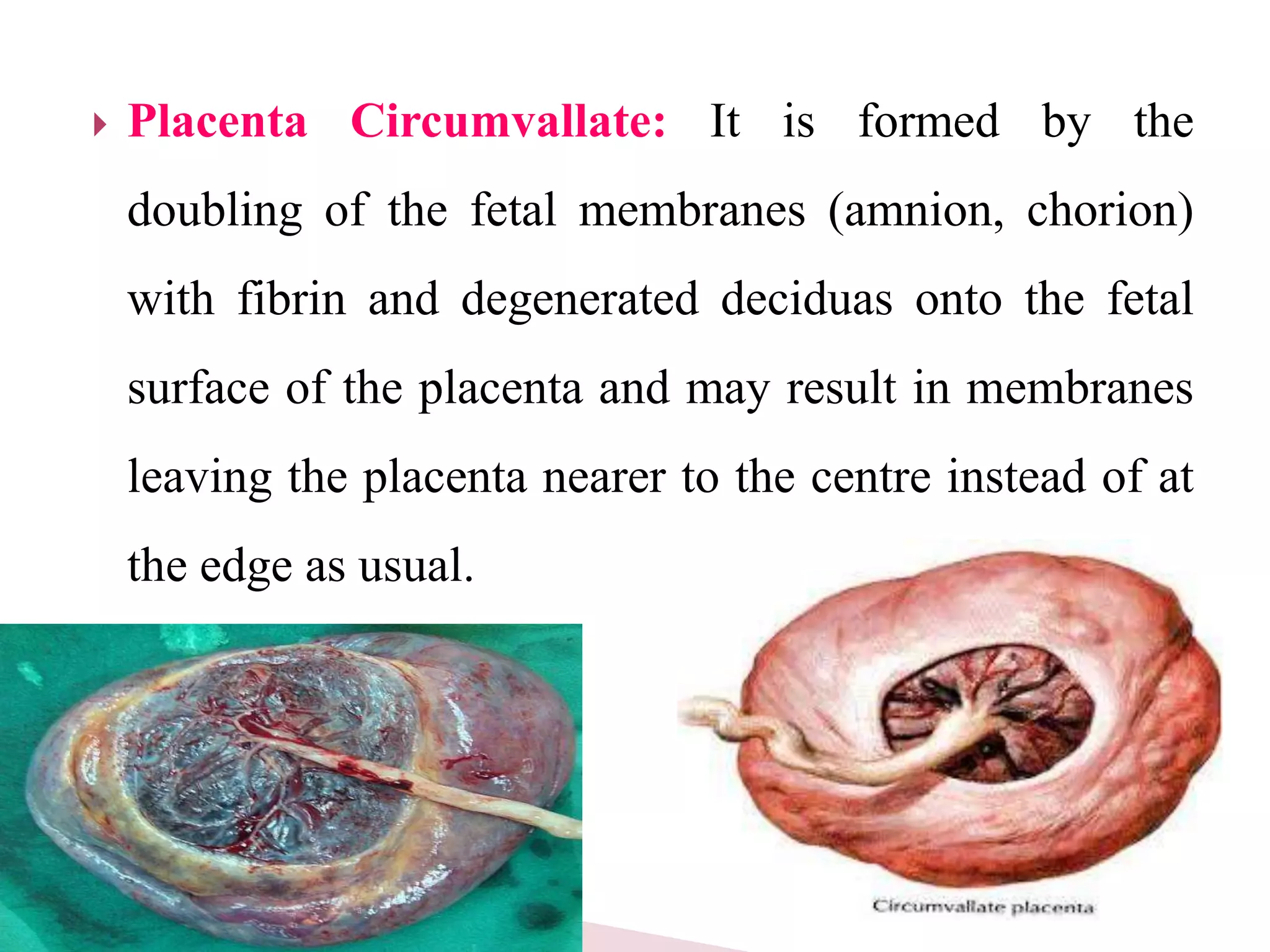 Abnormalities of placenta & cord.pptx