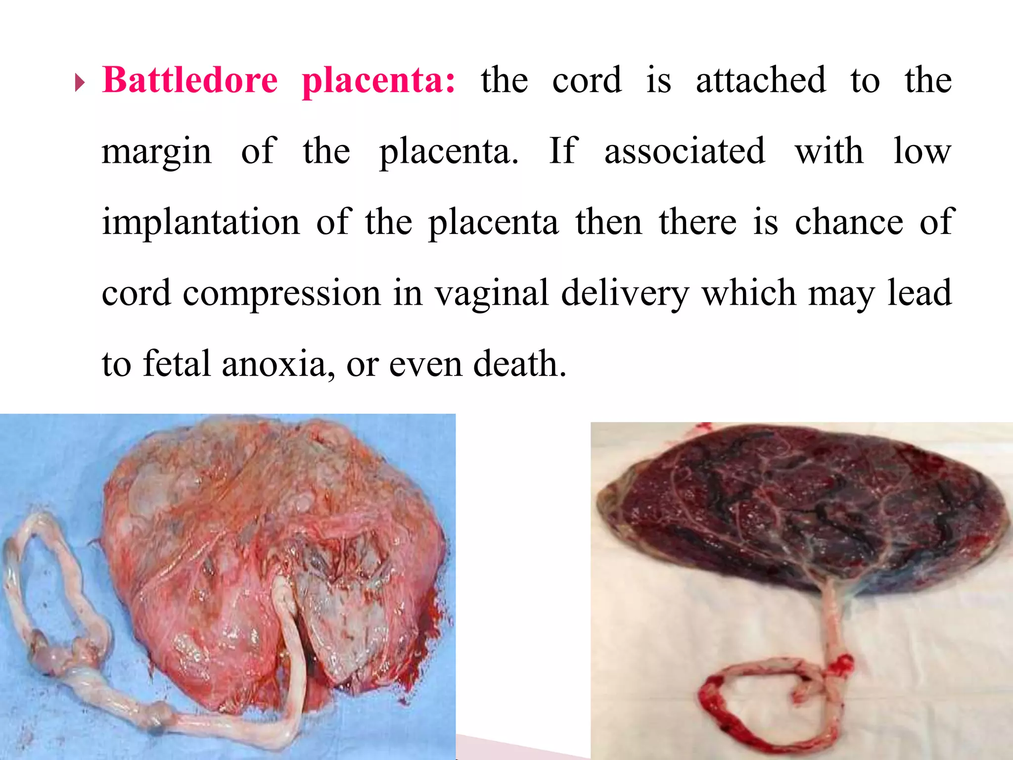 Abnormalities of placenta & cord.pptx