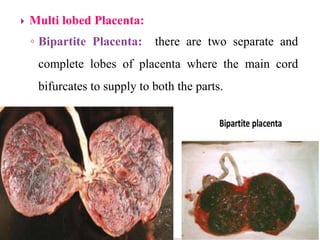 Abnormalities of placenta & cord.pptx