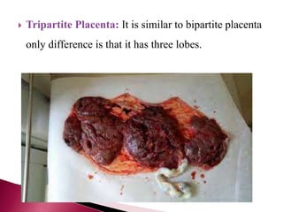 Abnormalities of placenta & cord.pptx