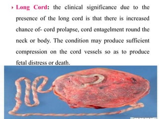 Abnormalities of placenta & cord.pptx