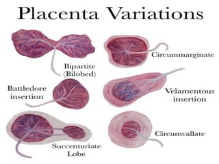 Abnormalities of placenta & cord.pptx
