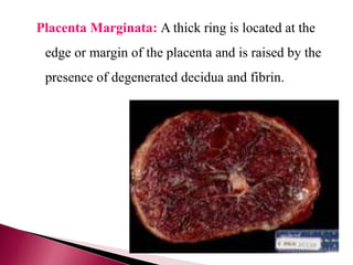 Abnormalities of placenta & cord.pptx