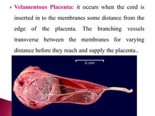 Abnormalities of placenta & cord.pptx