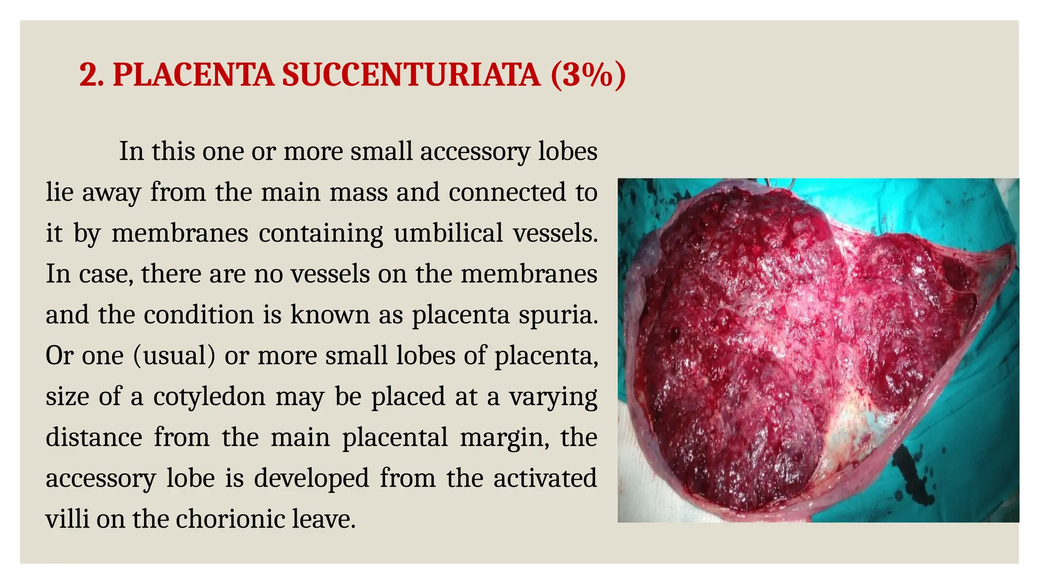 ABNORMALITIES OF PLACENTA & UMBILICAL CORD.pptx