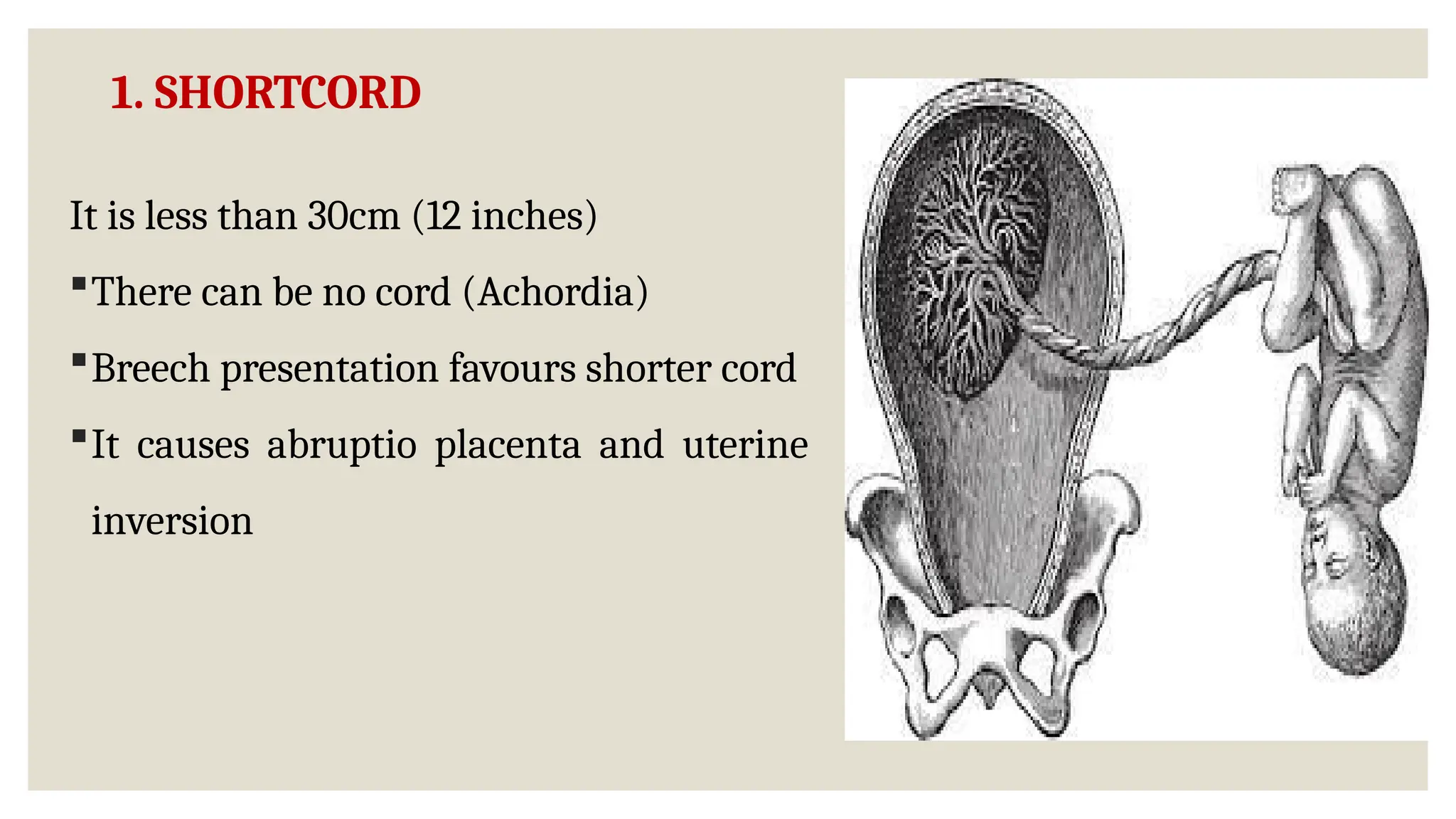 ABNORMALITIES OF PLACENTA & UMBILICAL CORD.pptx