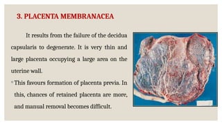 ABNORMALITIES OF PLACENTA & UMBILICAL CORD.pptx