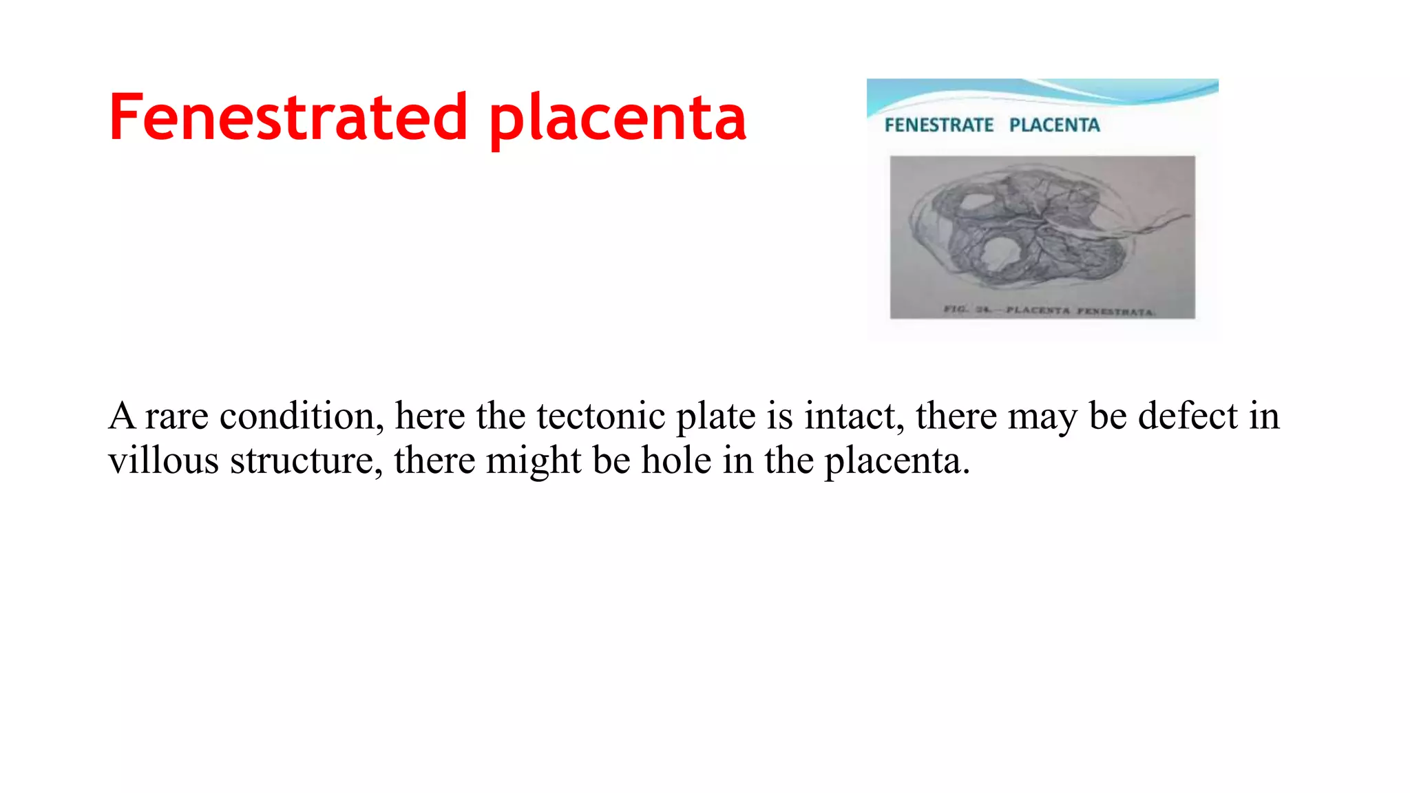 Abnormalities of placenta_cord_and_membrane | PPTX