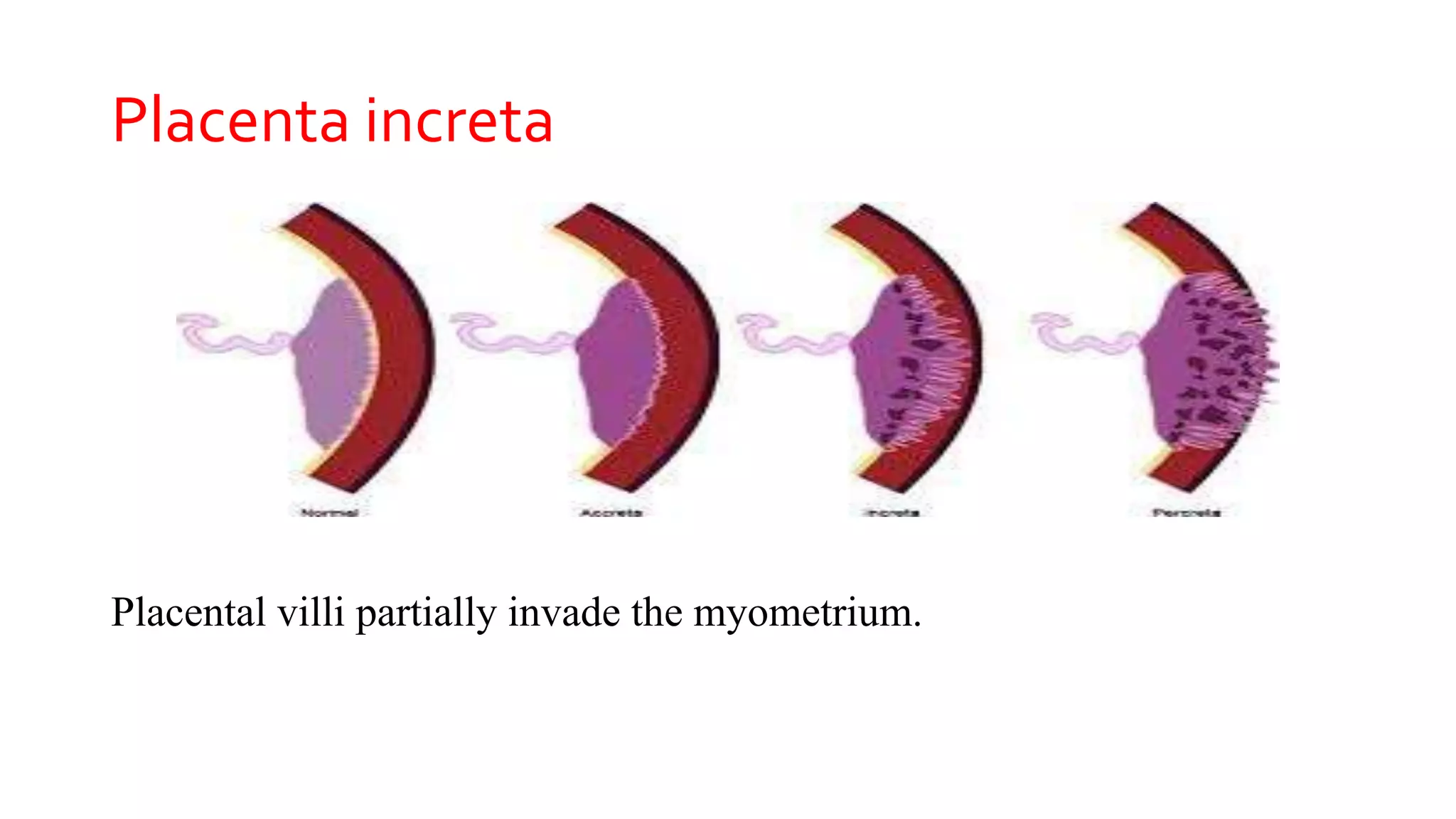Abnormalities of placenta_cord_and_membrane | PPTX