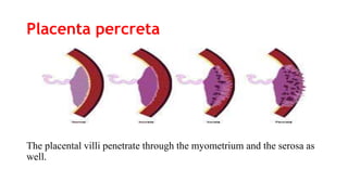 Abnormalities of placenta_cord_and_membrane | PPTX