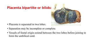 Abnormalities of placenta_cord_and_membrane | PPTX