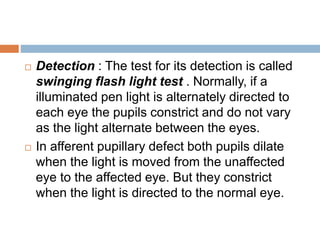 Abnormalities of pupil | PPT