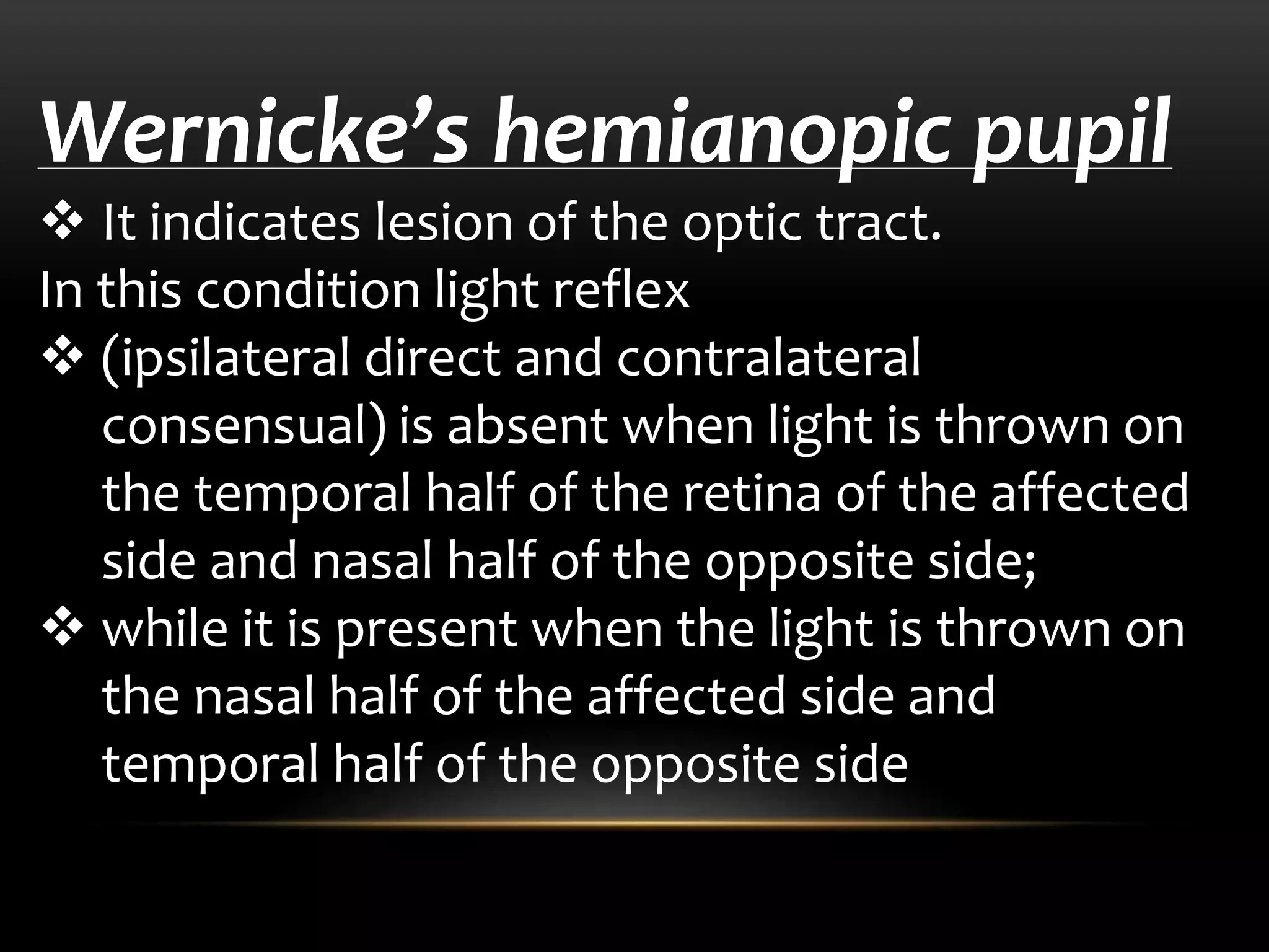 Abnormalities of pupillary reaction | PPTX