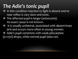 Abnormalities of pupillary reaction | PPTX