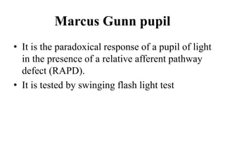 Abnormalities of pupillary reaction.pptx