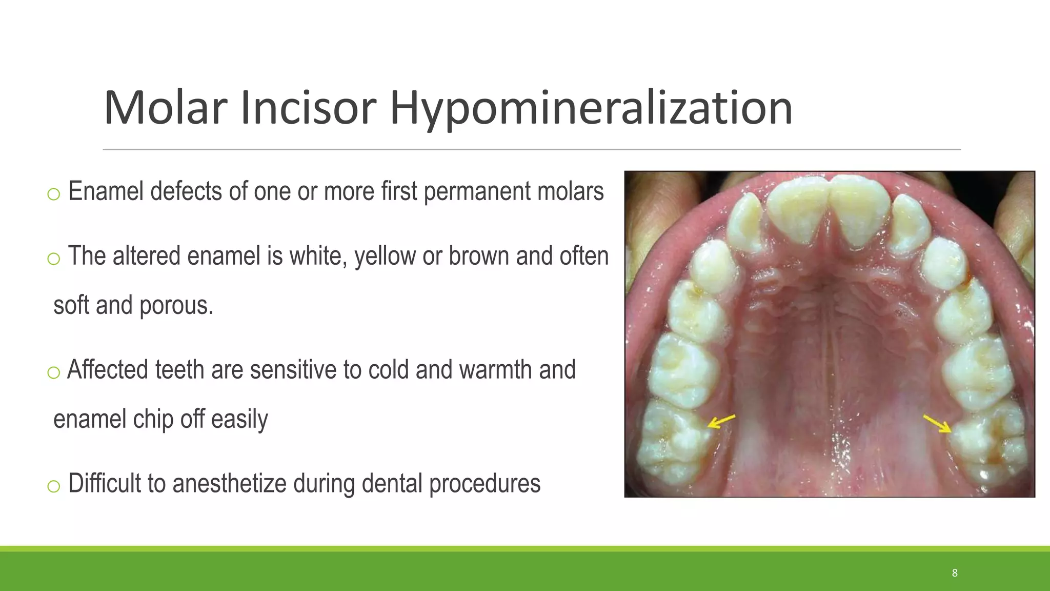 Abnormalities of teeth | PPTX