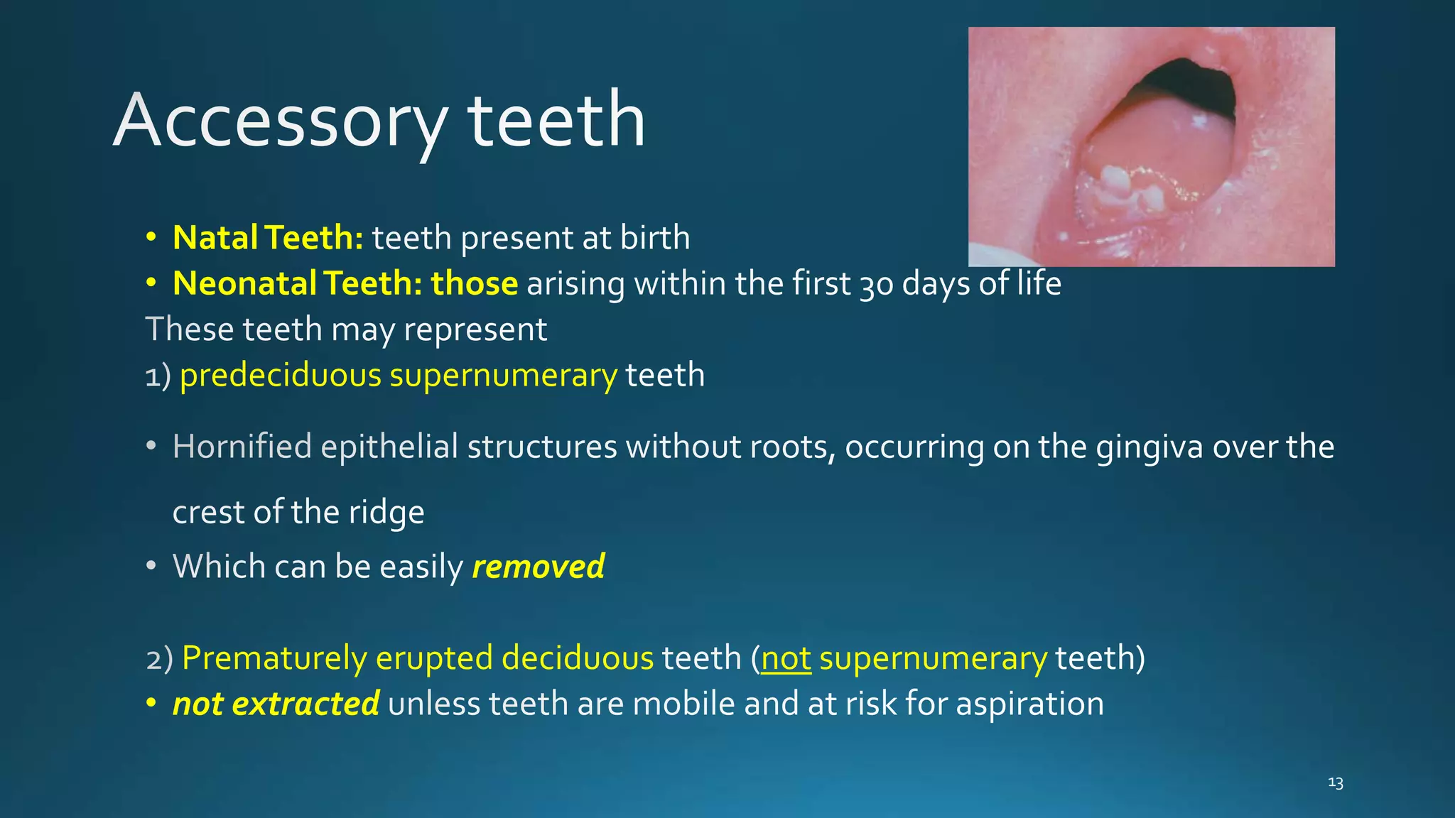 Abnormalities of teeth | PPTX