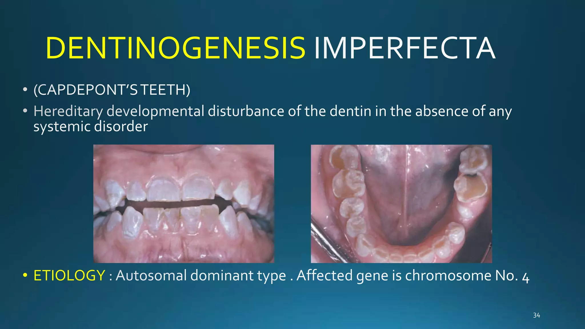 Abnormalities of teeth | PPTX