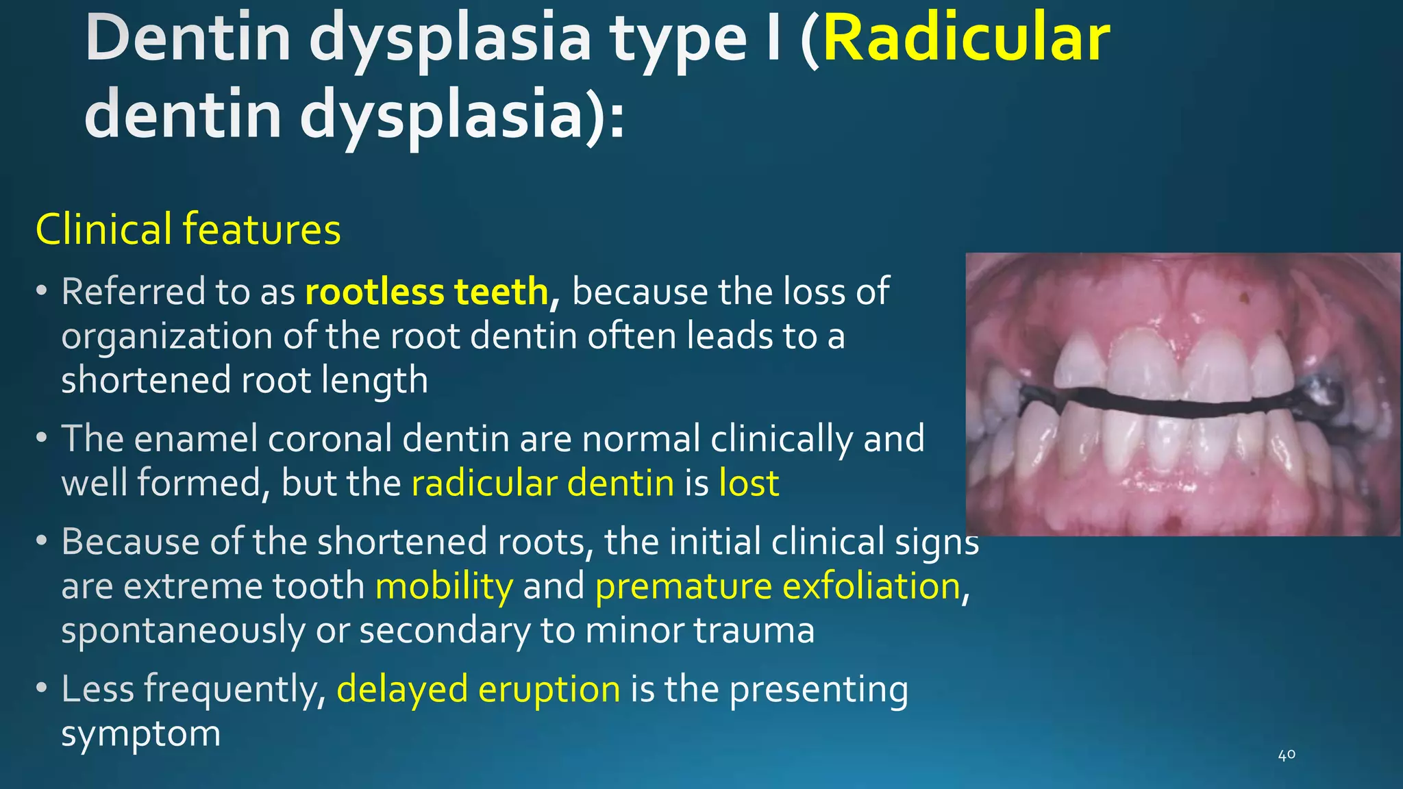 Abnormalities of teeth | PPTX | Dental Health | Diseases and Conditions