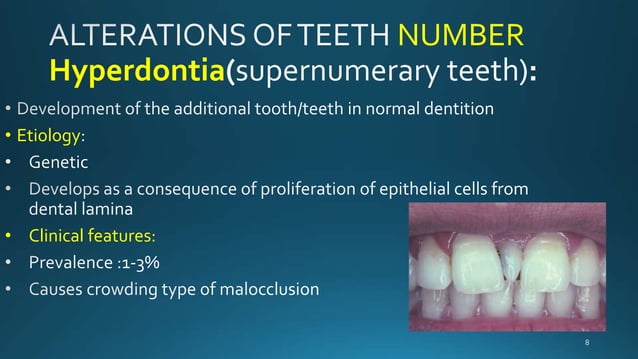 Abnormalities of teeth | PPTX | Dental Health | Diseases and Conditions