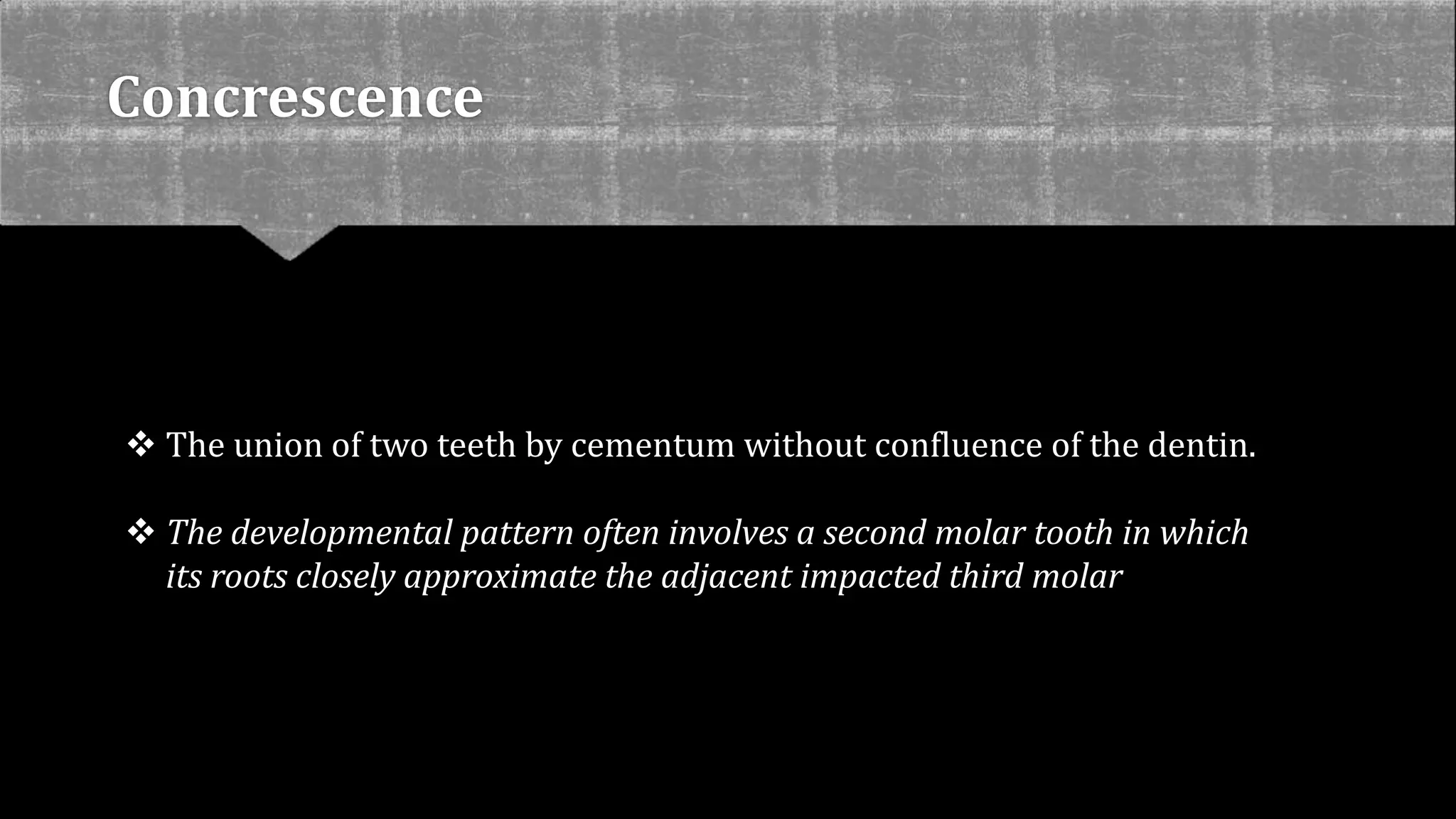 Abnormalities of teeth | PPTX