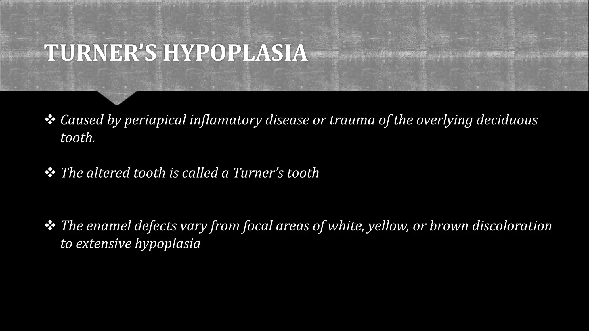 Abnormalities of teeth | PPTX