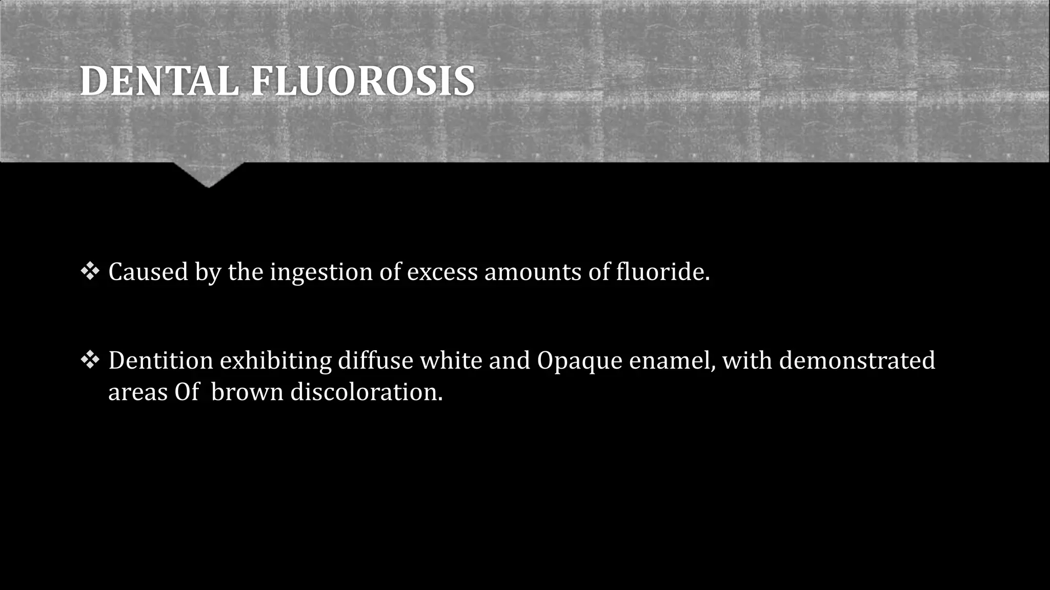 Abnormalities of teeth | PPTX