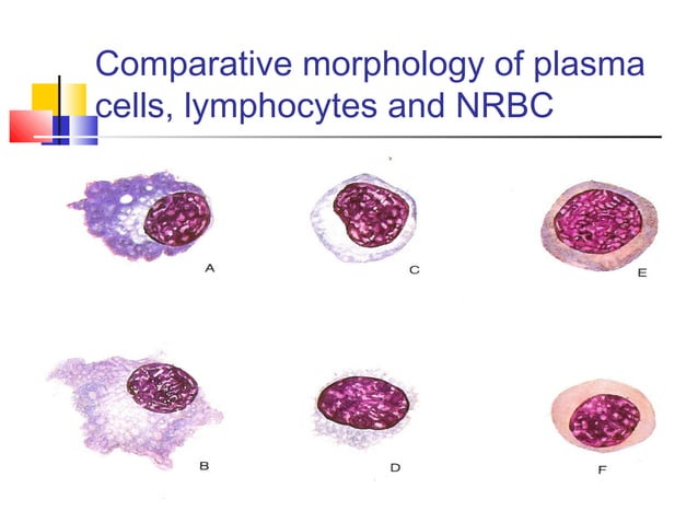 Abnormalities of WBC | PPT