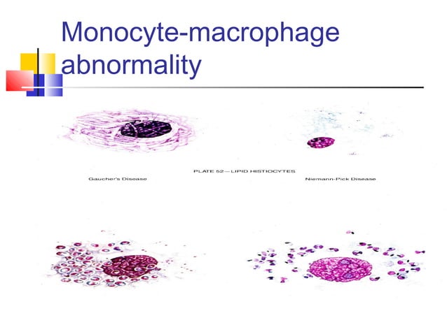 Abnormalities of WBC | PPT