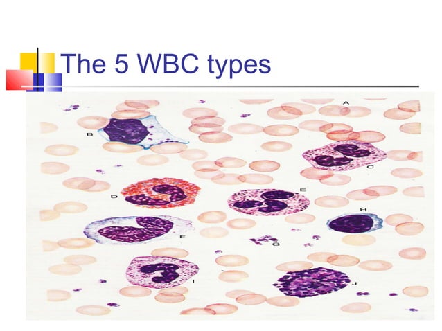 Abnormalities of WBC | PPT