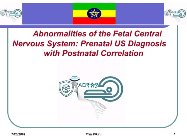 Abnormalities of the Fetal Central Nervous System Prenatal US Diagnosis ...